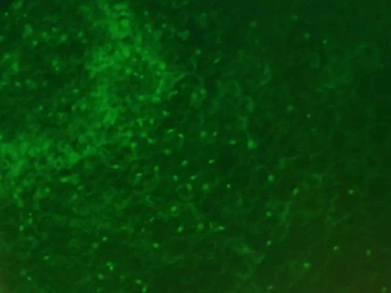 Zeiss Axiovert 200m Inverted Fluorescence Motorized Condenser ...